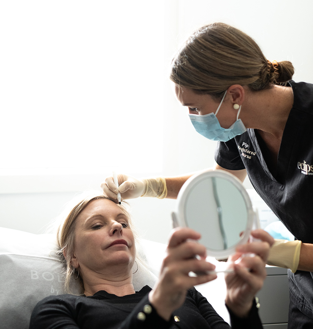 Marionette Lines Treatment | Albury Wodonga